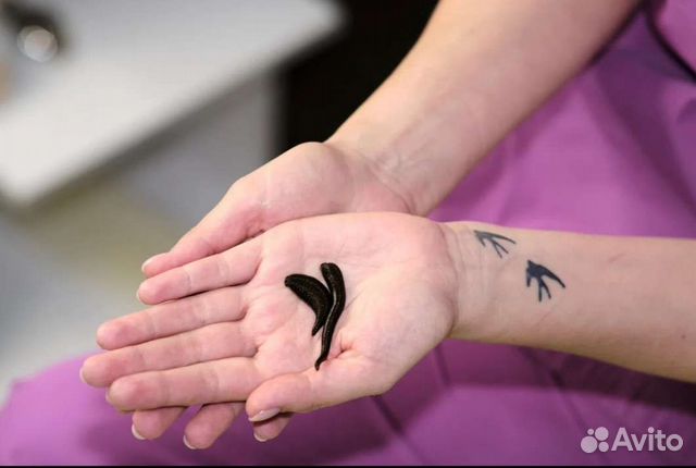 Пиявки медицинские